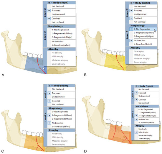 The Comprehensive AOCMF Classification System: Classification and ...