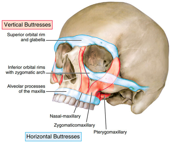 A Shift in Conceptual Thinking of Panfacial Fracture Sequencing: The ...