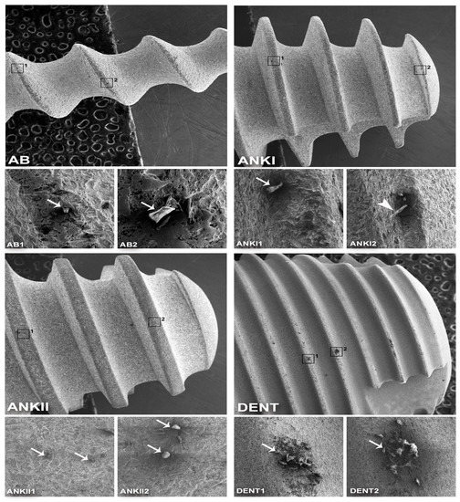 Assessment of the Chemical Composition in Different Dental Implant ...