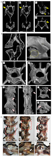 Application of Biodegradable PLGA-PEG-PLGA/CPC Composite Bone Cement in ...