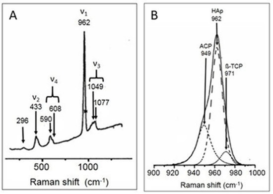 Structural Changes of Hydroxylapatite during Plasma Spraying: Raman and ...