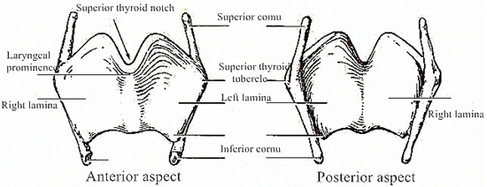 Design and Molding of Thyroid Cartilage Prosthesis Based on 3D Printing ...