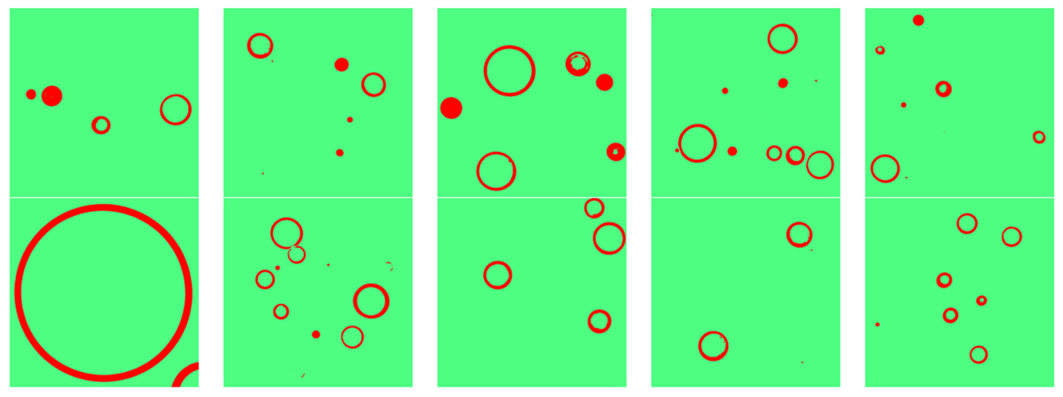 Microscopy-Assisted Digital Image Analysis with Trainable Weka Segmentation (TWS) for Emulsion ...