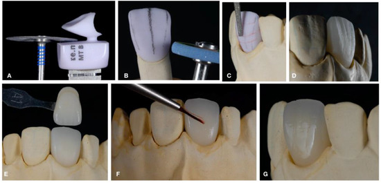 Dental Ceramics: Fabrication Methods and Aesthetic Characterization