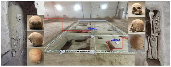 Multi-Analytical Study on Excavated Human Bones in the Burial ...