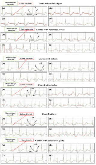 Effect of Fabric Electrode Surface Coating Medium on ECG Signal Quality ...