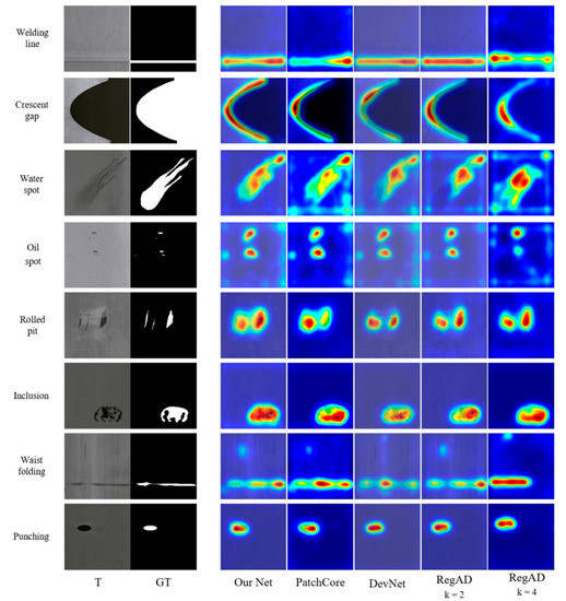 A Novel Anomaly Detection Method for Strip Steel Based on Multi-Scale ...