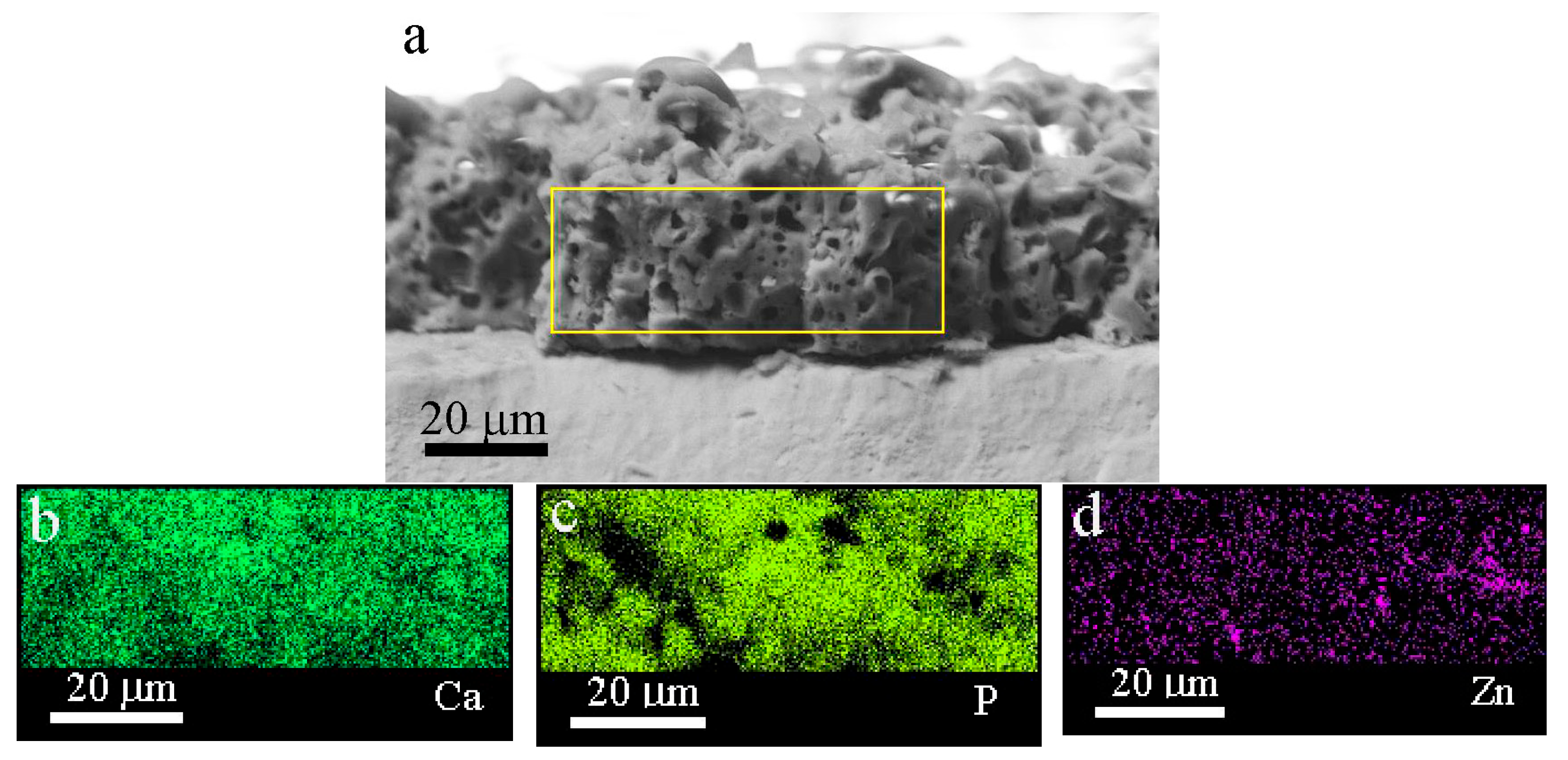 Coatings | Free Full-Text | Antibacterial Calcium Phosphate Coatings ...