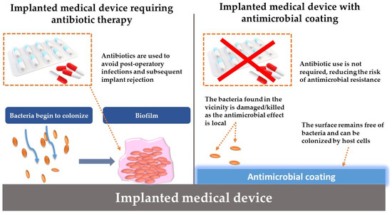 Advances in Antimicrobial Coatings for Preventing Infections of Head ...