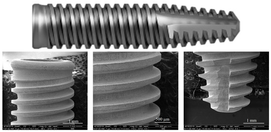 Clinical Analysis of the Influence of Surface Roughness in the Primary ...