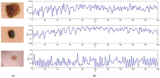 An SVM Framework for Malignant Melanoma Detection Based on Optimized HOG Features
