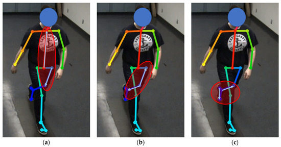 Video-Based Deep Learning Approach for 3D Human Movement Analysis in ...