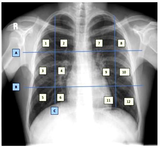 Explainable Artificial Intelligence Approach for the Early Prediction ...