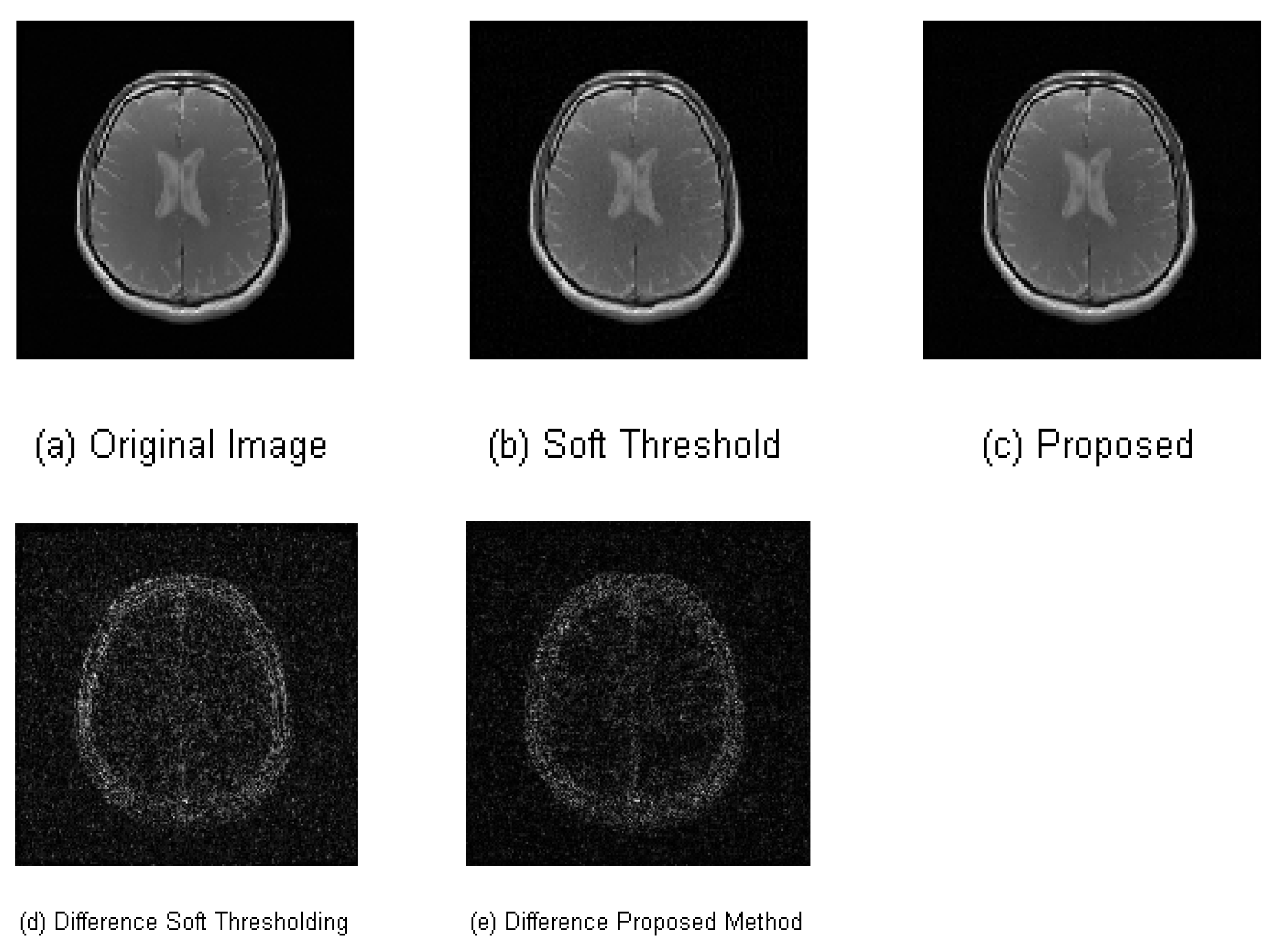 Computation | Free Full-Text | Sparse Reconstruction Using Hyperbolic Tangent as Smooth l1-Norm ...