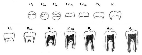 Dental Age Estimation Using Deep Learning: A Comparative Survey