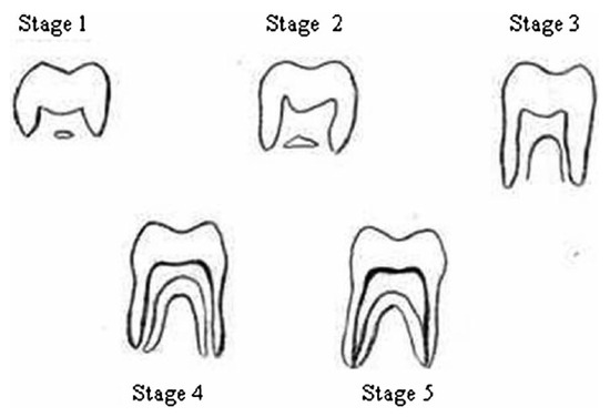 Dental Age Estimation Using Deep Learning: A Comparative Survey