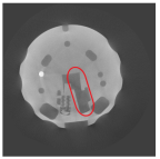 Incremental Learning-Based Algorithm for Anomaly Detection Using Computed Tomography Data