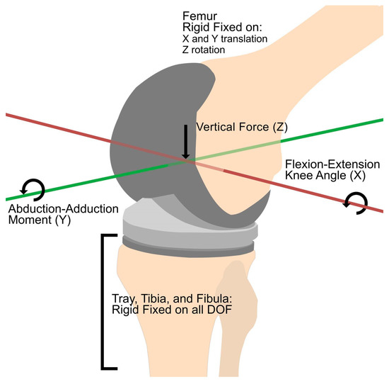 Finite Element Analysis of ACL Reconstruction-Compatible Knee Implant ...