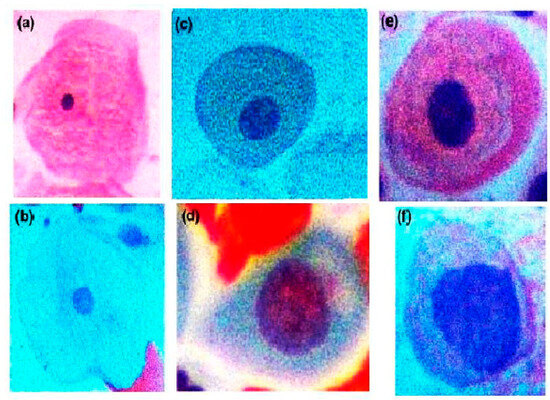 A Robust Deep Learning Approach for Accurate Segmentation of Cytoplasm and Nucleus in Noisy Pap ...
