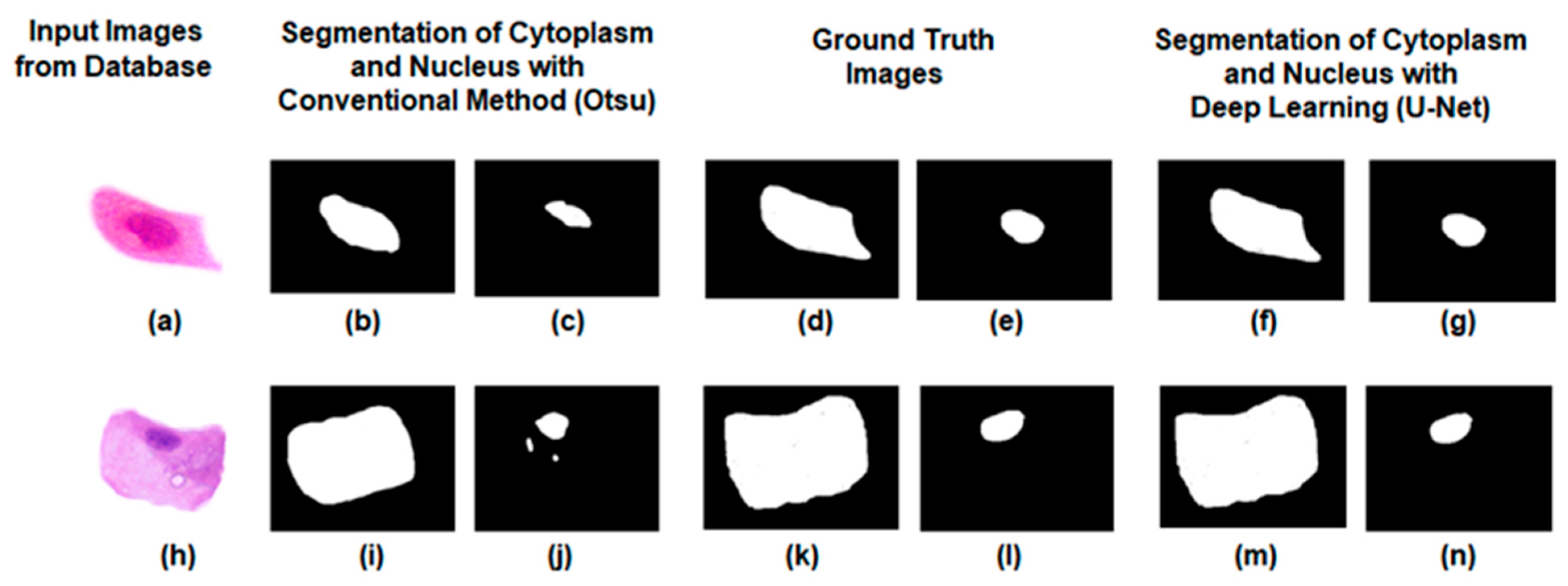 A Robust Deep Learning Approach for Accurate Segmentation of Cytoplasm and Nucleus in Noisy Pap ...
