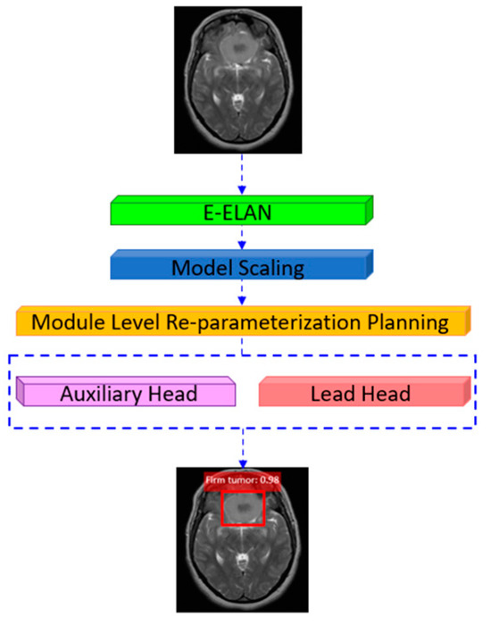 Computation | Free Full-Text | A Deep Learning Approach for Brain Tumor ...