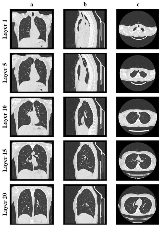 Mathematical Modeling of the Drug Particles Deposition in the Human ...