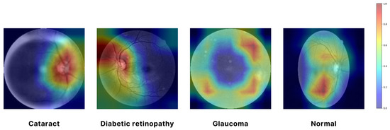 Bayesian Optimized Machine Learning Model for Automated Eye Disease ...