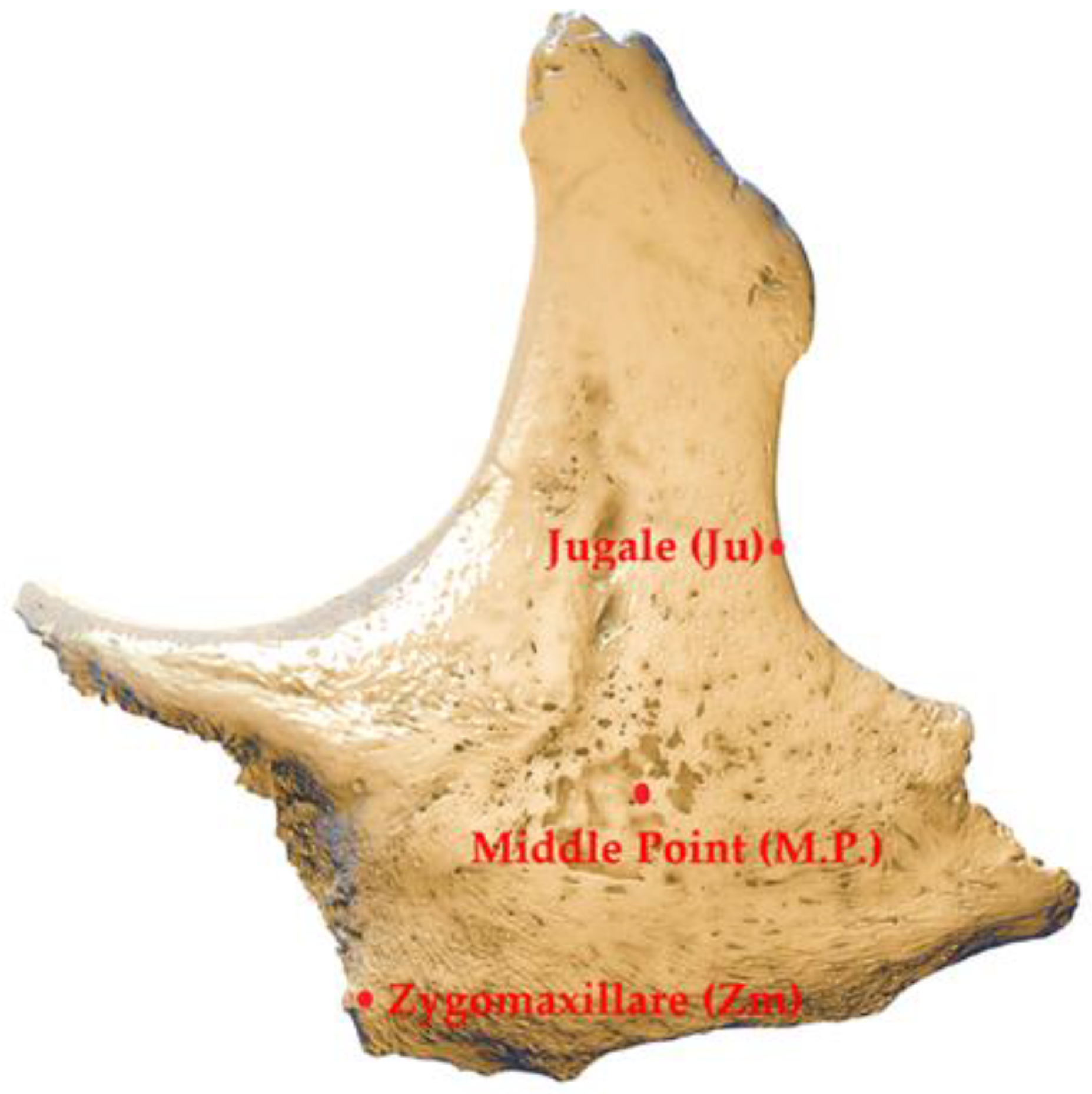 Design of Trabecular Bone Mimicking Voronoi Lattice-Based Scaffolds and ...