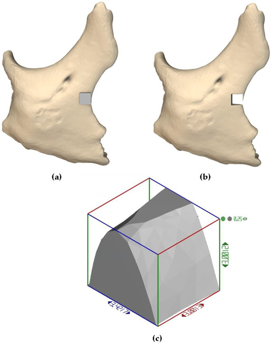Design of Trabecular Bone Mimicking Voronoi Lattice-Based Scaffolds and ...