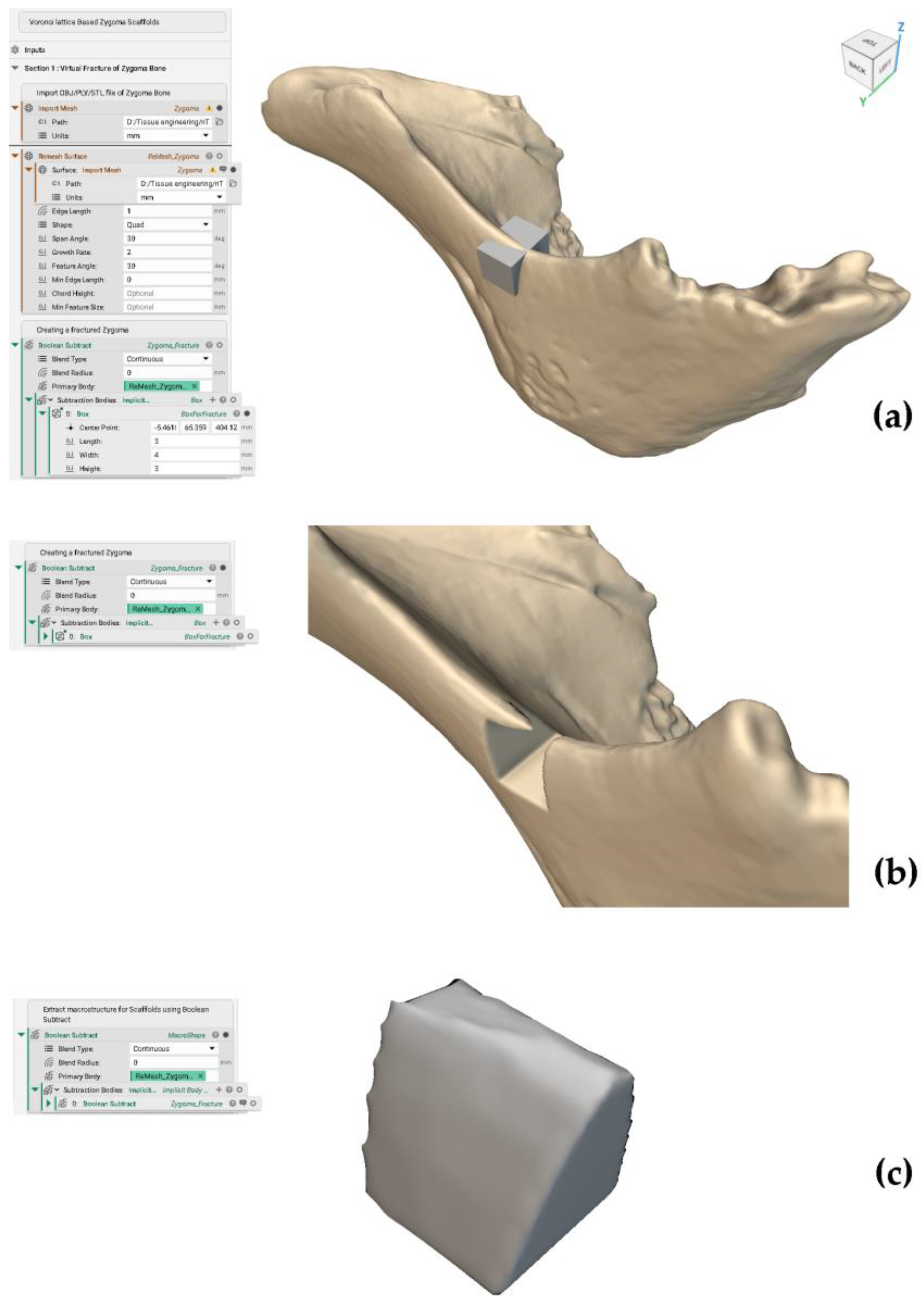 Design of Trabecular Bone Mimicking Voronoi Lattice-Based Scaffolds and ...