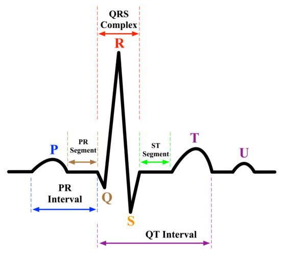 Uncertainty-Aware Deep Learning-Based Cardiac Arrhythmias Classification Model of ...