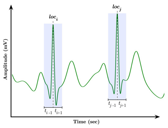 Computers | Free Full-Text | Uncertainty-Aware Deep Learning-Based Cardiac Arrhythmias ...
