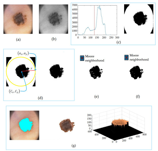 Melanoma Detection in Dermoscopic Images Using a Cellular Automata Classifier