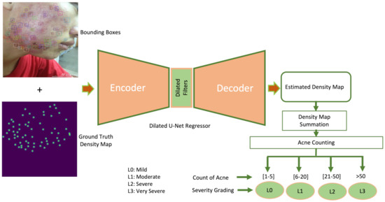 Attention Mechanism Guided Deep Regression Model for Acne Severity Grading