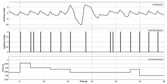 On the Feasibility of Real-Time HRV Estimation Using Overly Noisy PPG ...