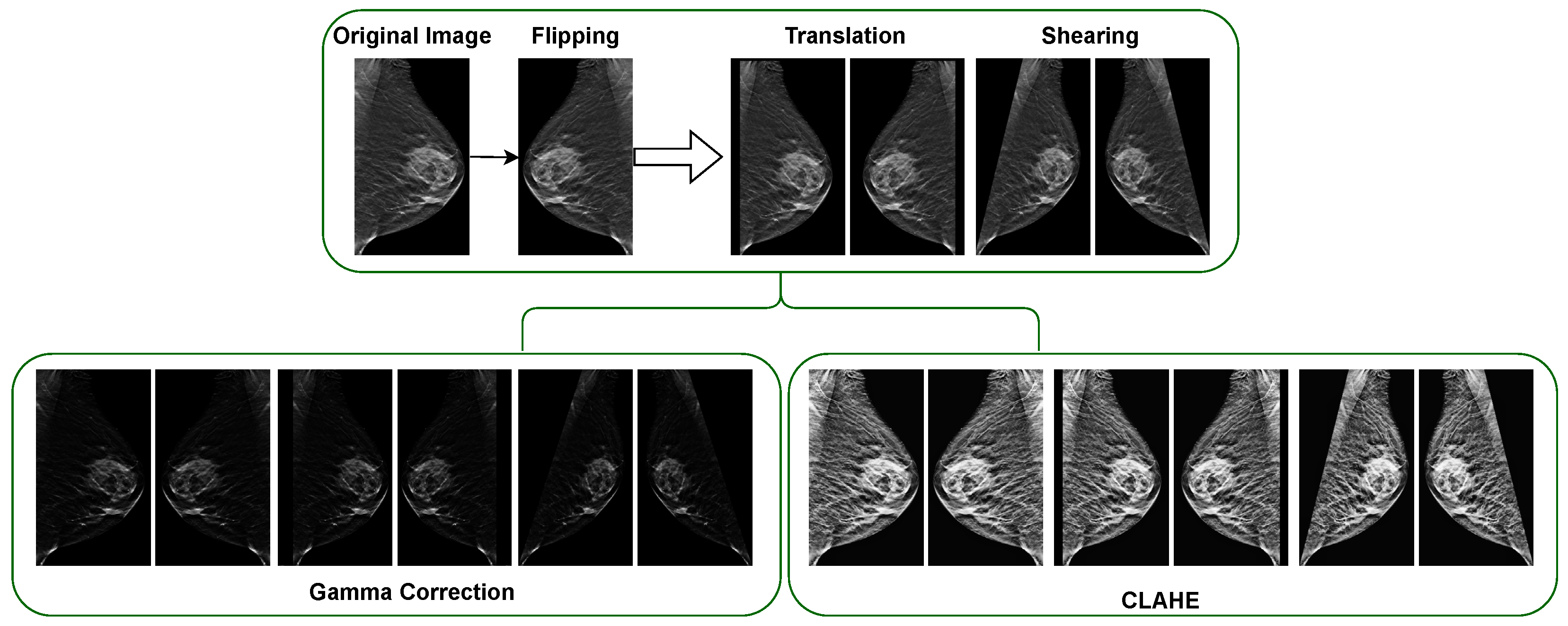 Detecting Breast Tumors in Tomosynthesis Images Utilizing Deep Learning ...