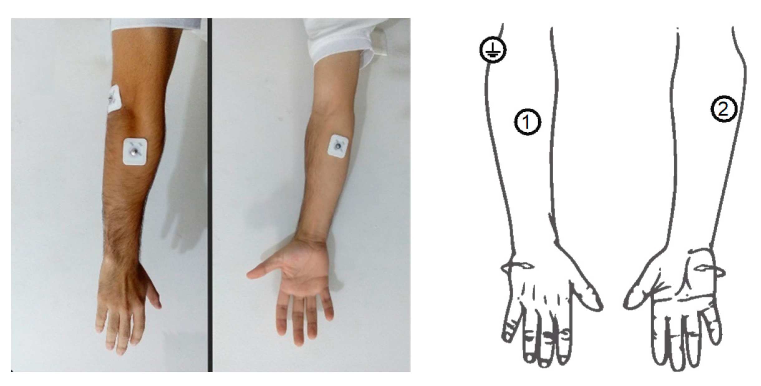 Implementation of an Intelligent EMG Signal Classifier Using Open ...