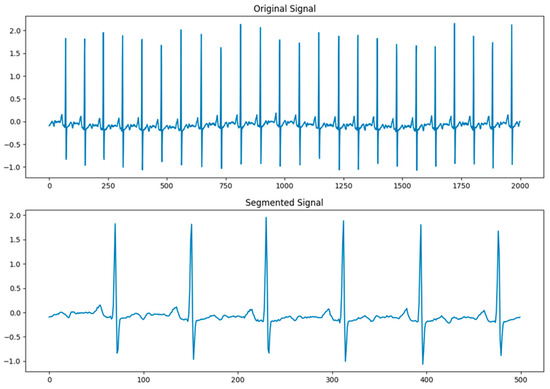 Electrocardiogram Signals Classification Using Deep-Learning-Based ...