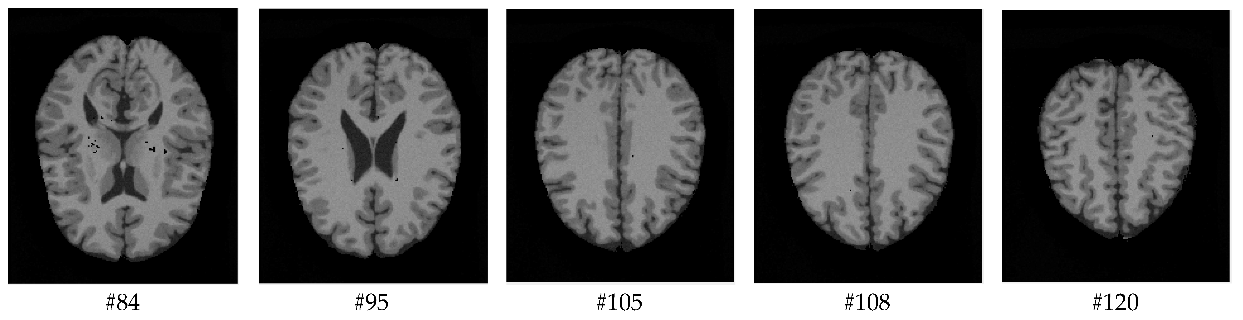 Computers | Free Full-Text | Enhancing Brain Segmentation in MRI through Integration of Hidden ...
