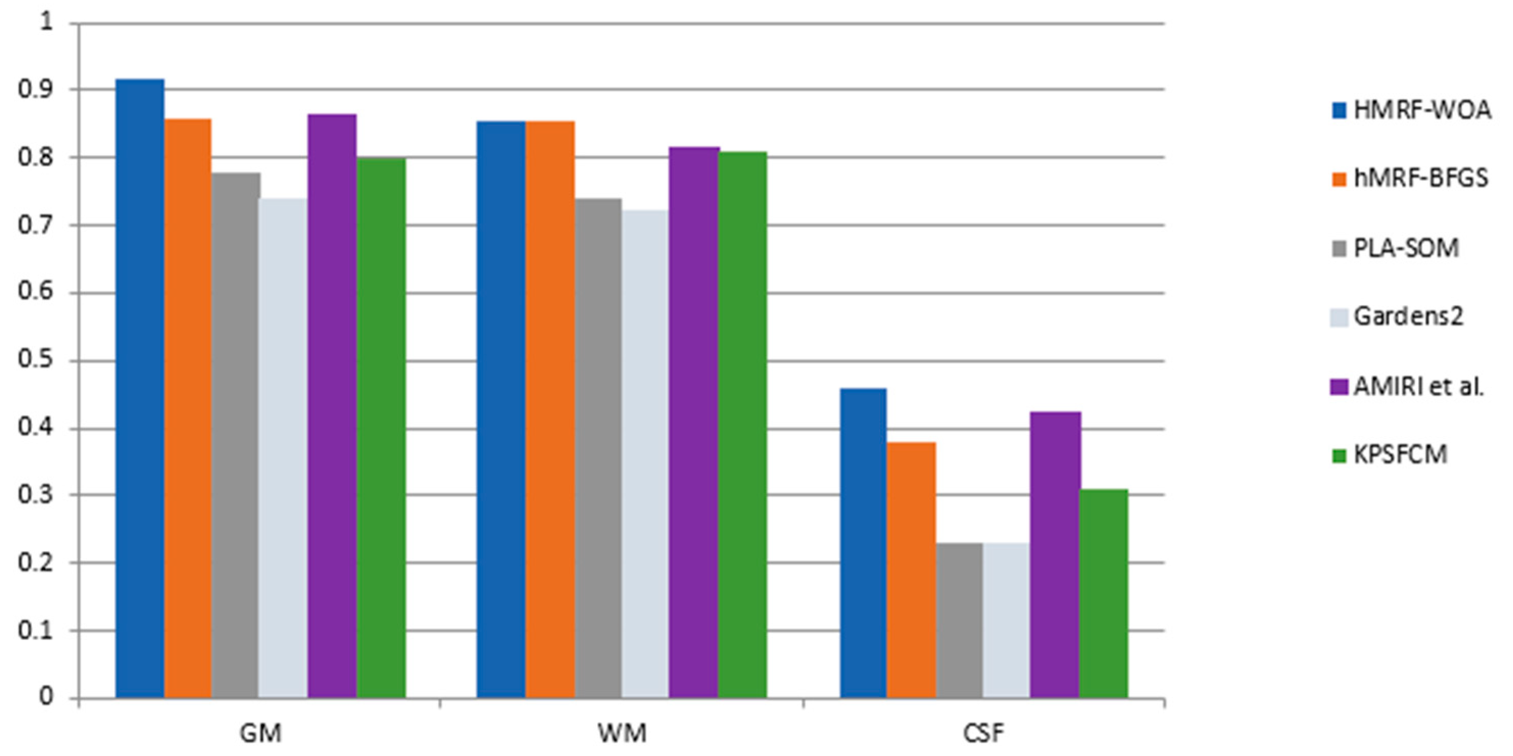 Computers | Free Full-Text | Enhancing Brain Segmentation in MRI ...