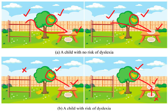 Directional Perception in Game-Based Dyslexia Risk Screening: A Mouse ...