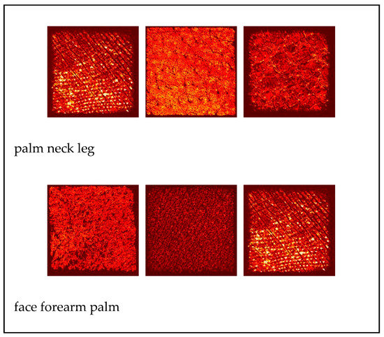 The Development of a Skin Image Analysis Tool by Using Machine Learning ...
