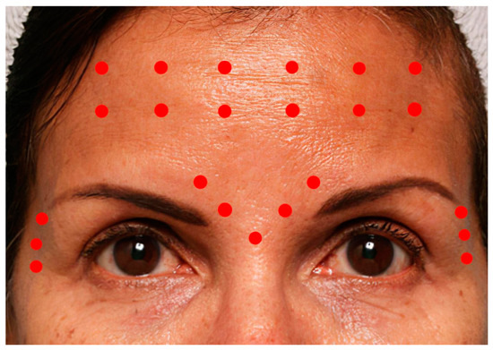 Expert Opinion on Non-Surgical Eyebrow Lifting and Shaping Procedures