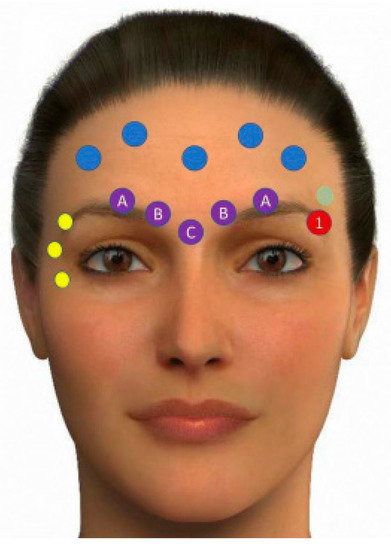 Expert Opinion on Non-Surgical Eyebrow Lifting and Shaping Procedures