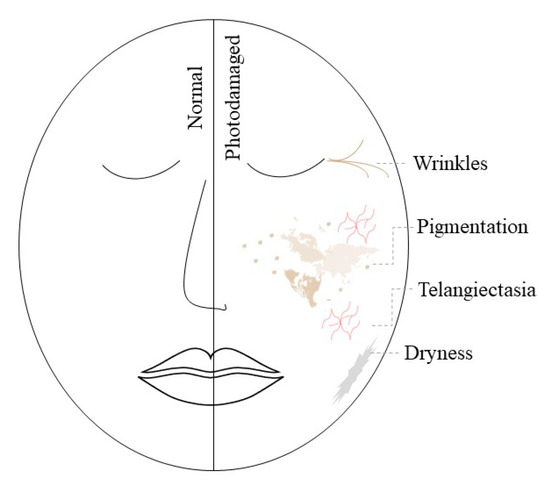 Advancement of All-Trans Retinoic Acid Delivery Systems in ...