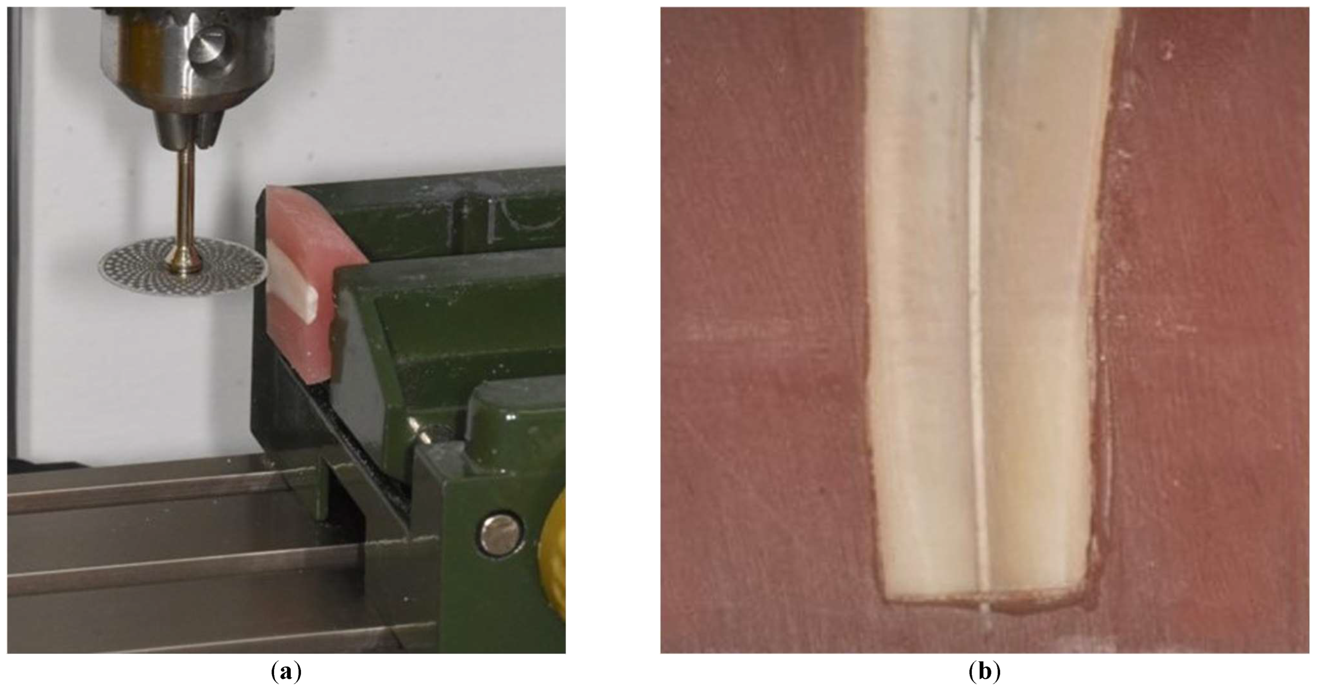 Radicular Intracanal Splitting Forces and Cutting Efficiency of NiTi ...