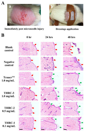 Biocompatible Triple-Helical Recombinant Collagen Dressings for Accelerated Wound Healing in ...