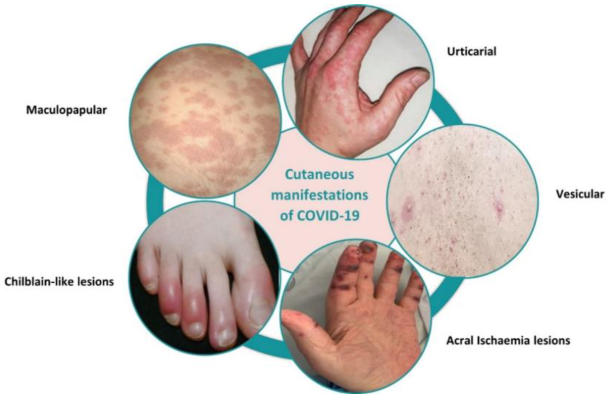 Cosmetics | Free Full-Text | The Pandemic and Your Skin—Direct and Indirect Impact of COVID-19