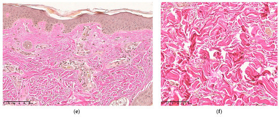 A New Approach toward the Management of Patients with Premature Skin ...