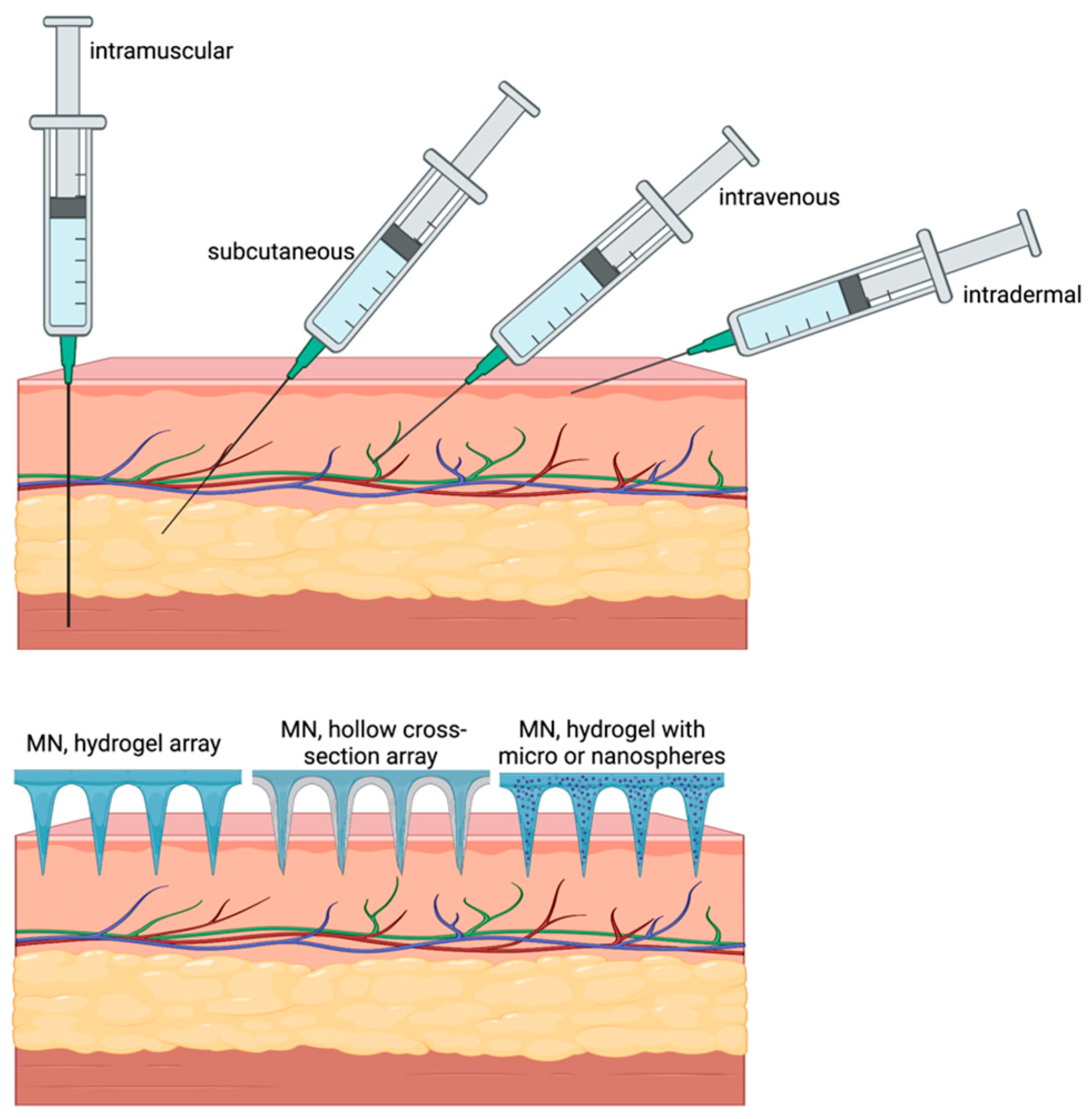Current Insights into the Formulation and Delivery of Therapeutic and ...